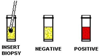RAPID UREASE TEST | Medil.gr
